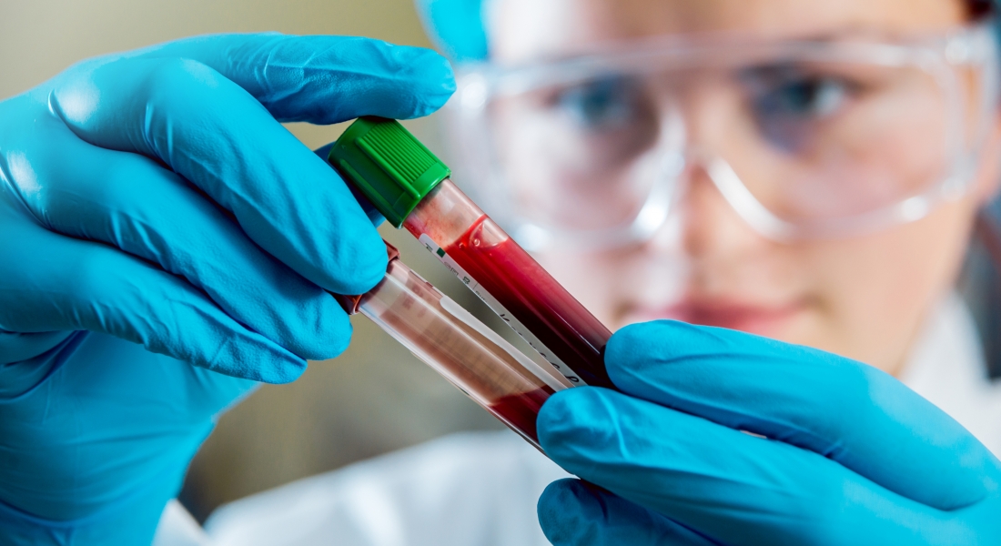 Overview Of Anticoagulants & Antiplatelets - Island Medical Consultants